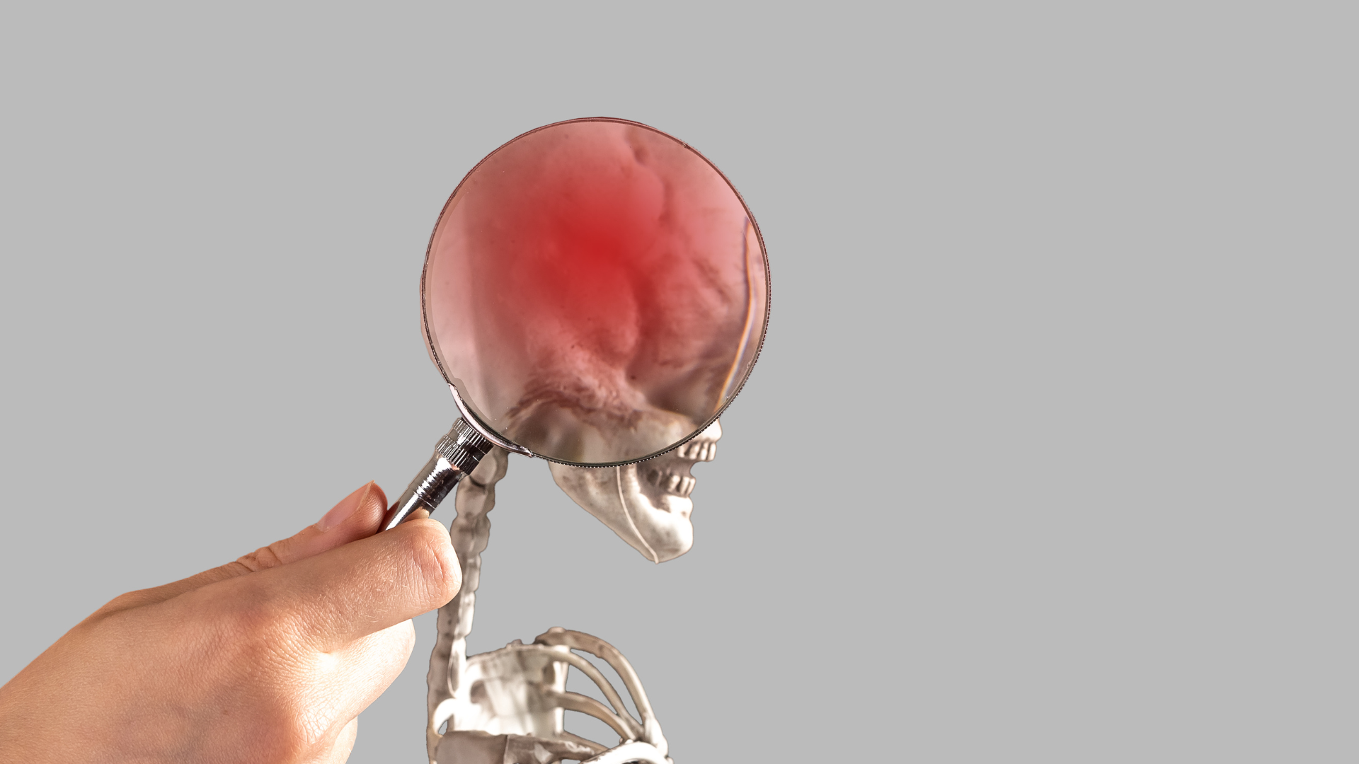 Defense Verdict re Allegations of Bowel Obstruction Causing Stroke|NY ...